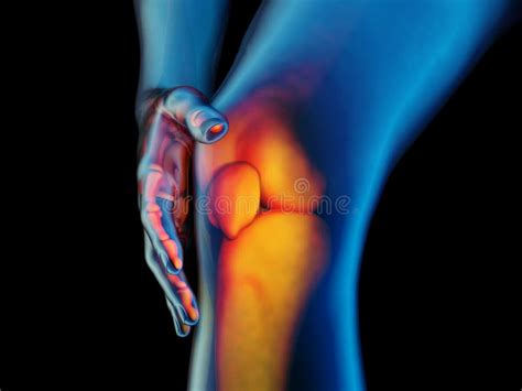 Pain Stock Illustration Illustration Of Human Bone 316116755