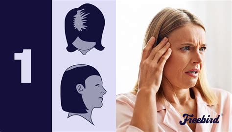 The Ludwig Scale Stages Of Female Pattern Hair Loss Freebird