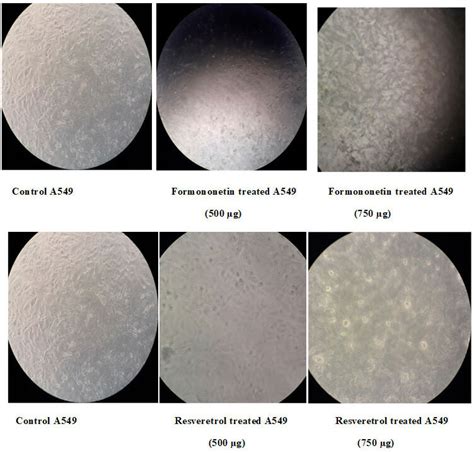 Effect Of Formononetin And Resveratrol On Morphology Of A549 Cells
