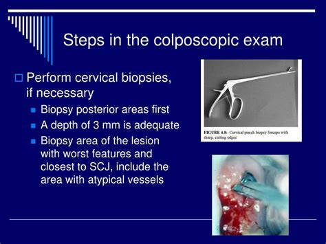 Ppt Colposcopy Powerpoint Presentation Free Download Id275680