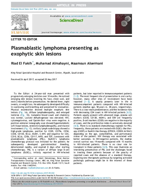 Pdf Plasmablastic Lymphoma Presenting As Exophytic Skin Lesions Hitham Almahayni