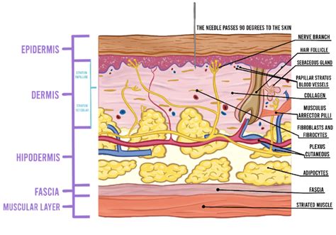 Needle Insertion At A 90 Degree Angle During Skin Penetration Passes