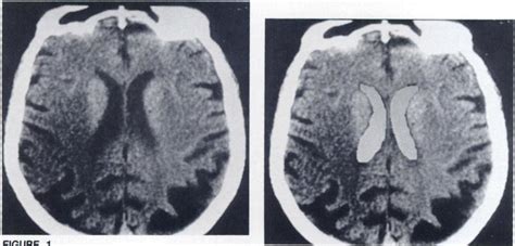 Digitized Image From Representative Xct Scan Section As Photographed Download Scientific