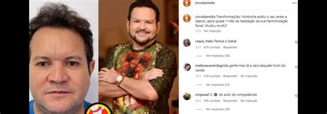 Foto Antes E Depois De Ximbinha Dividiu Opiniões E Rendeu Comparações