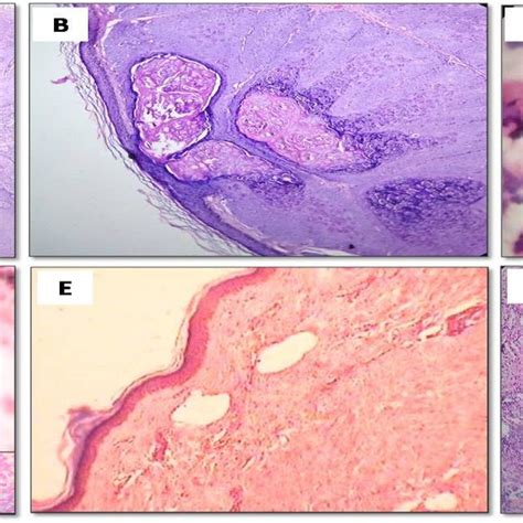 Distribution Of Vulvar Lesions Download Scientific Diagram