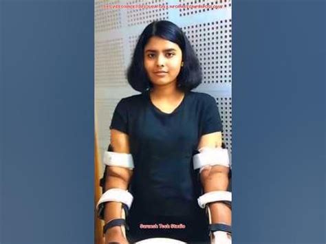 Shreya Siddanagowder Hand Transplant Amazing Han Transplant Shorts