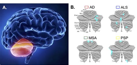 Pictures Of Cerebellum
