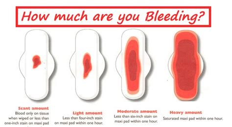 Heavy Menstrual Bleeding Menorrhagia Healthtips By Teleme