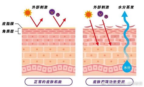 皮肤屏障是什么？你都了解吗？ 知乎