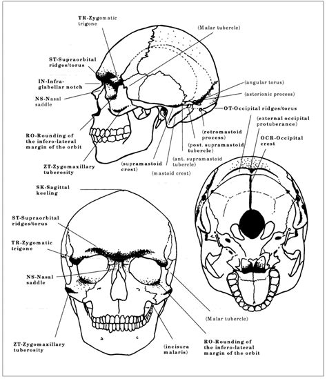 Cranial Superstructures In Bold The Features Of Robusticity Scored As