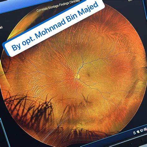 Mohnnad Bin Majed Posted On Linkedin