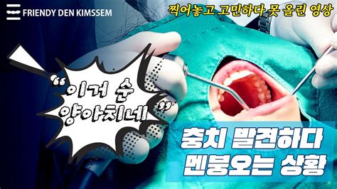 충치가 생겼다는 치과의사의 말을 믿겠습니까 Youtube