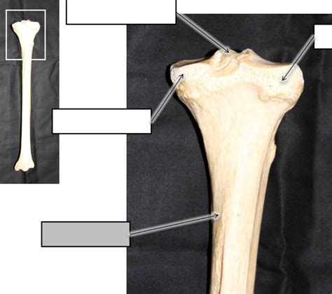 Tibia Diagram Quizlet