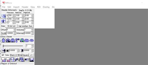 Mricro のインストール，操作手順例（windows 上）