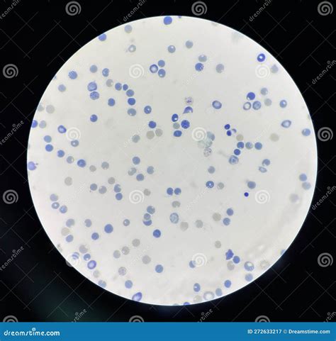 Reticulocyte Count Under Microscope 40x Methylene Blue Staining Stock