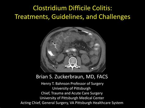 Pdf Clostridium Difficile Colitis Treatments Guidelines And