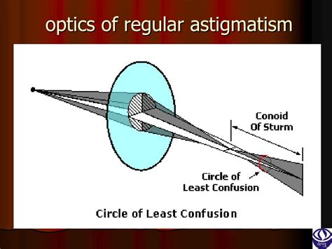 Ppt Astigmatism Powerpoint Presentation Free Download Id2759100