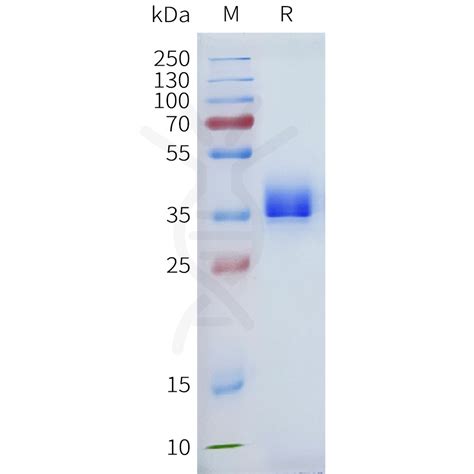 Human Pd L1 Protein Tag Free 专注肿瘤免疫