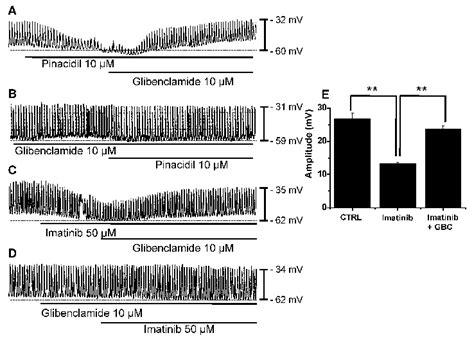 Effects Of Pinacidil And Imatinib On Pacemaker Potentials In Cultured