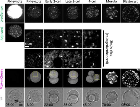 Figures And Data In Endosomal Lysosomal Organellar Assembly Elysa