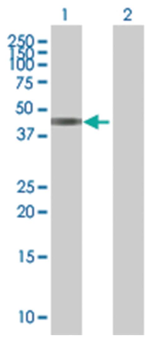 Tcf19 293t Cell Overexpression Lysate Denatured Abnova 100μlprotein