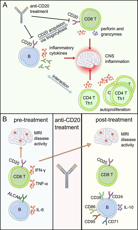 Cd20陽性細胞とは Cd20モノクローナル抗体 Cd分類 Ruor
