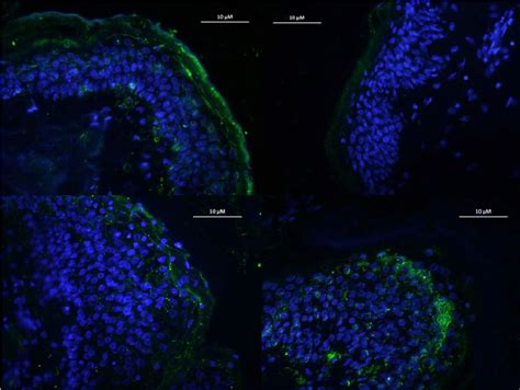 Claudin 6 Expression In Skin Explants Irradiated B Or Not A By Uva