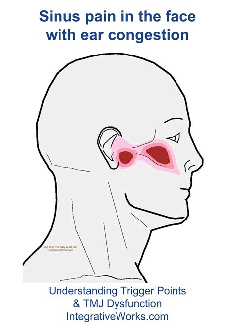 Sinuses Of The Face Sinus Infection Sinusitis Symptoms And Treatment