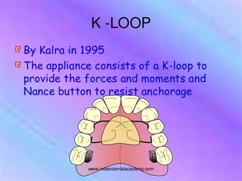 K Loop Certified Fixed Orthodontic Courses By Indian Dental Academy