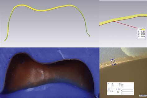 Suitability Of The Triple Scan Method With A Dental Laboratory Scanner