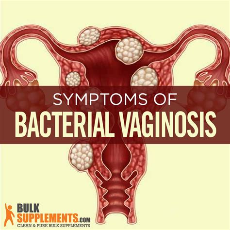 Bacterial Vaginosis Symptoms Causes Treatment