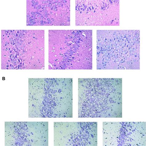 A Hematoxylin And Eosin Staining Of Neuronal Cells In The Hippocampal
