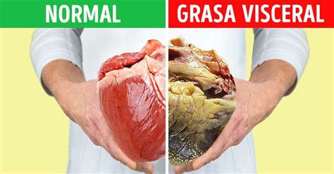 Qué es la grasa visceral y por qué es importante reducirla Genial