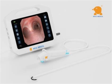 Understanding Bronchoscopy Endoscopy Procedures