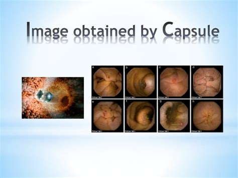 Pill Camera Pptx