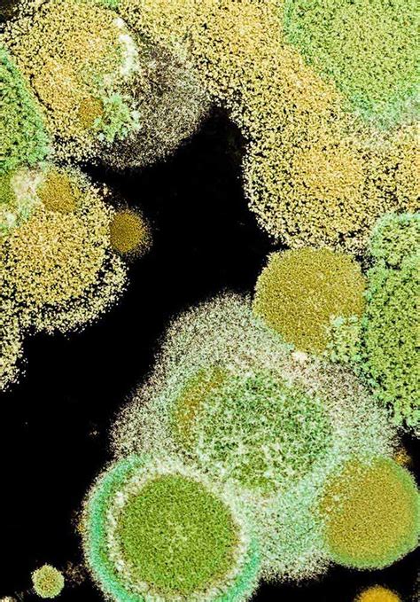 Introductory Chapter Identification And Isolation Of Trichoderma Spp
