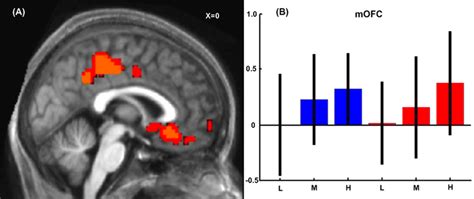 A Regions Where Activation Correlated With The Difference In Value
