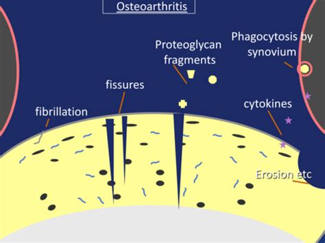 Surgery Final Joints Healing Assimilation Pt Dysplasia Flashcards