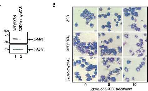 Figure 1 From Granulocytic Differentiation Of Normal Hematopoietic