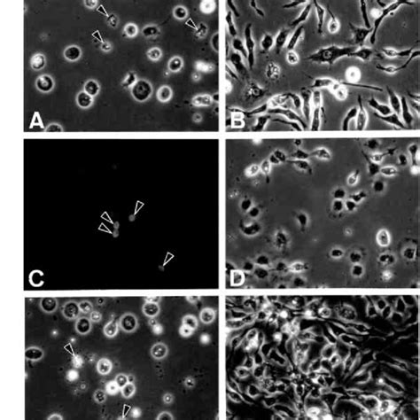 Phases Of C Elegans Embryonic And Postembryonic Development Embryonic Download Scientific
