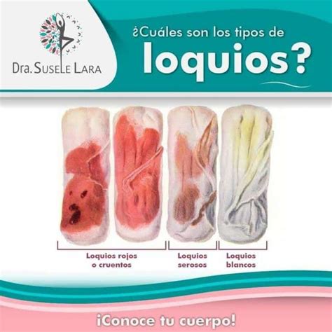 Por Qu Hay Sangrado Despu S Del Parto Mibbmemima