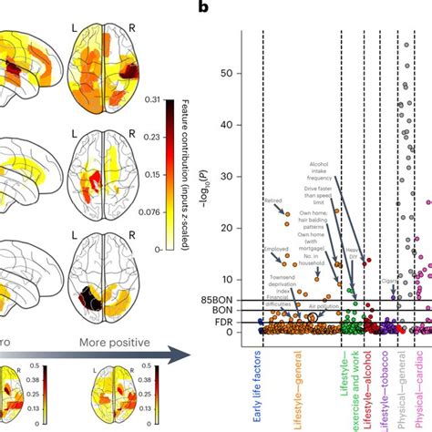 The Leading Whole Brain Asymmetry Pattern Spotlights Shifts In The