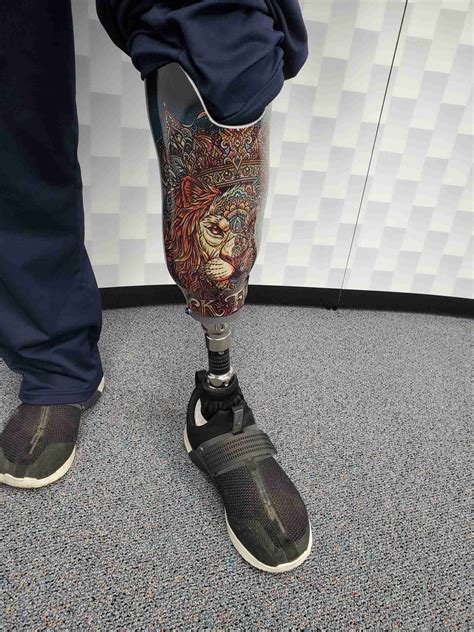 custom socket art for lower body prosthetics united prosthetics