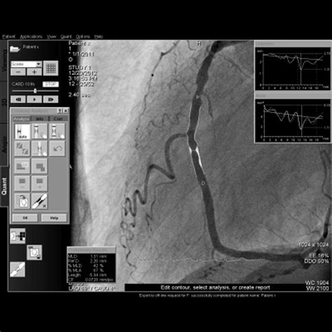 Scientific Qca Analysis Siemens Healthineers