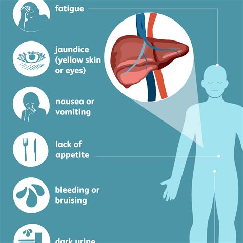 Hepatitis C Symptoms Image To U