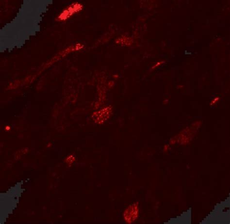 Transglutaminase 5 Antibody Bsa Free Nbp2 81857 Novus Biologicals