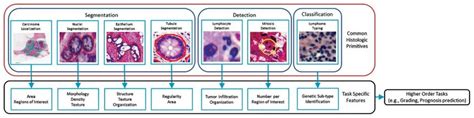 the workflow of pathology research for segmentation detection and