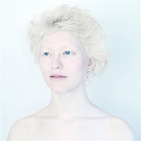 白化病女孩肖像：她們天生缺陷，但依舊美麗性感 每日頭條