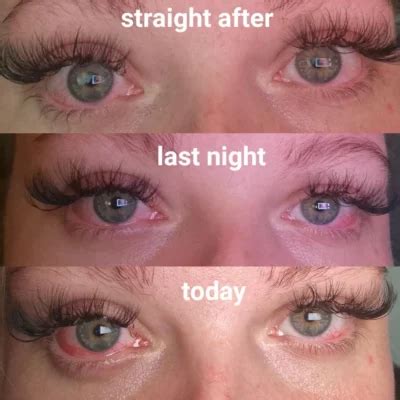 Lash Patch Test Why It Is Important And How To Do