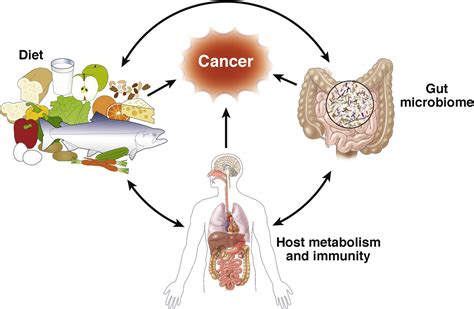 Diet Gut Microbiota And Colorectal Cancer Gutmicrobiotaforhealth